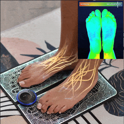 NMES Foot Massagers - Duares